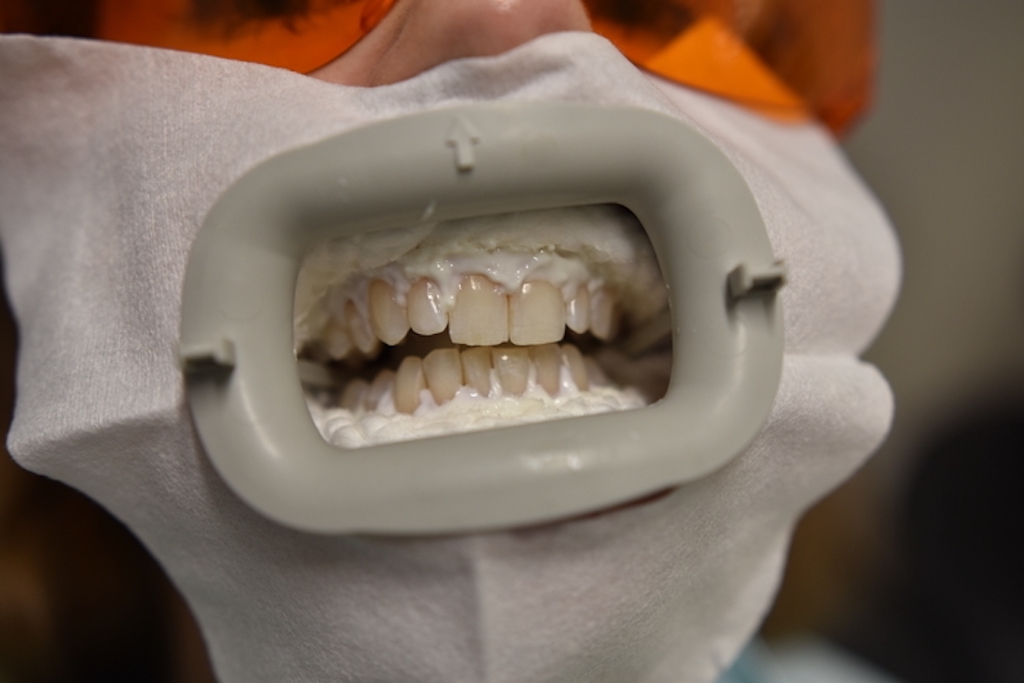 Clear Smiles Dental | Dental Care | Broward County