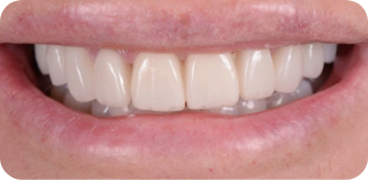 Clear Smiles Dental | Dental Care | Broward County