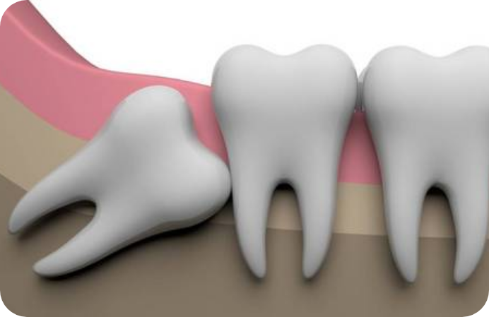 Comprehensive Oral Surgery Services - Clear Smiles Dental